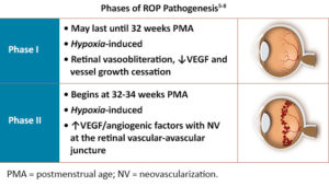 Pathophysiology – ROP | Clinician